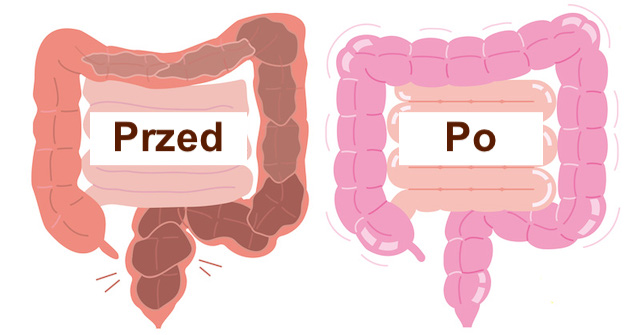 Oczyść swoje jelito grube za pomocą tych 8 lekarstw!